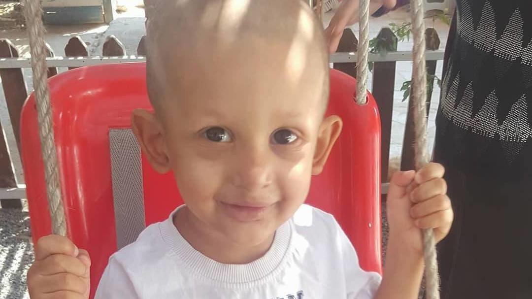 Kampanya · ektodermal displazi hastalığının ülkemizde % oranının ...