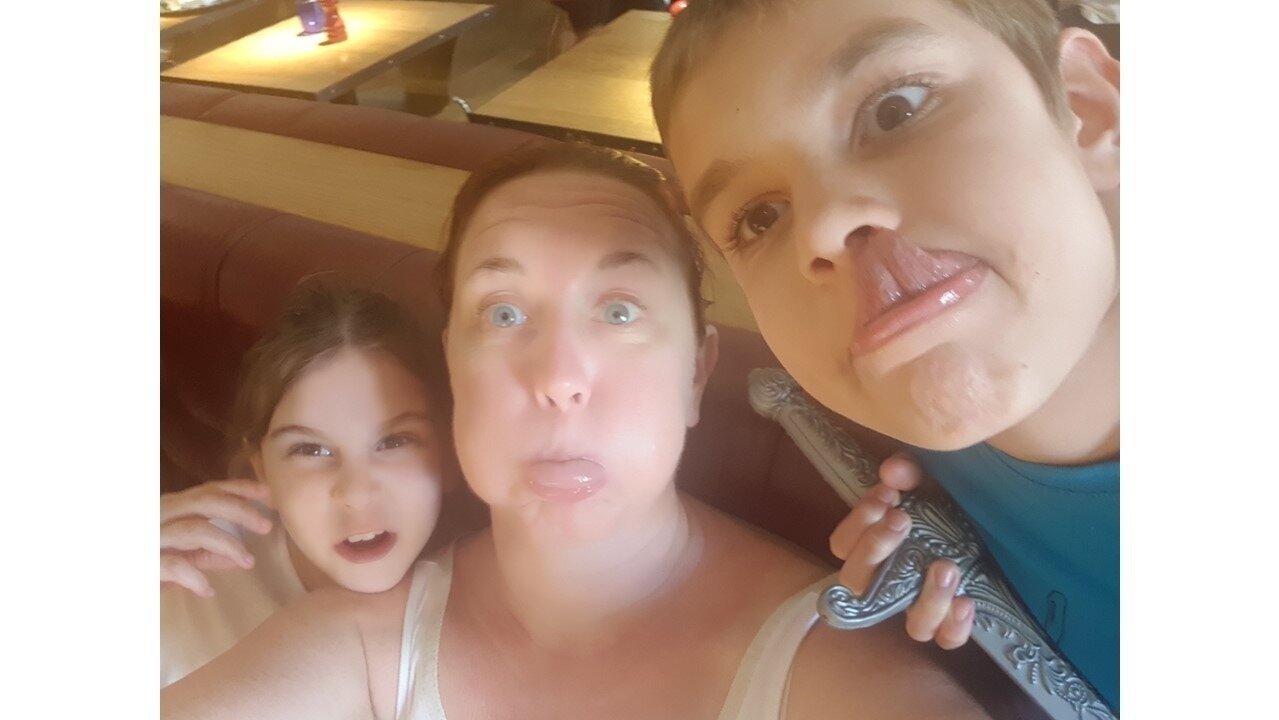 When Selfies Go Horribly Wrong