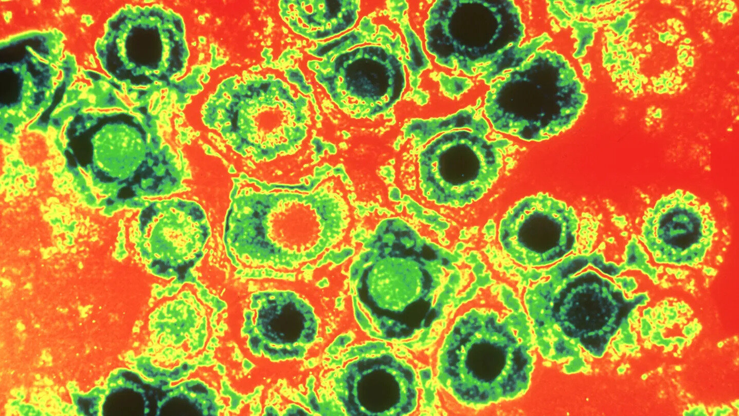 Petition · Fast-Track Moderna’s HSV-2 Vaccine & Fund HSV Cure Research ...