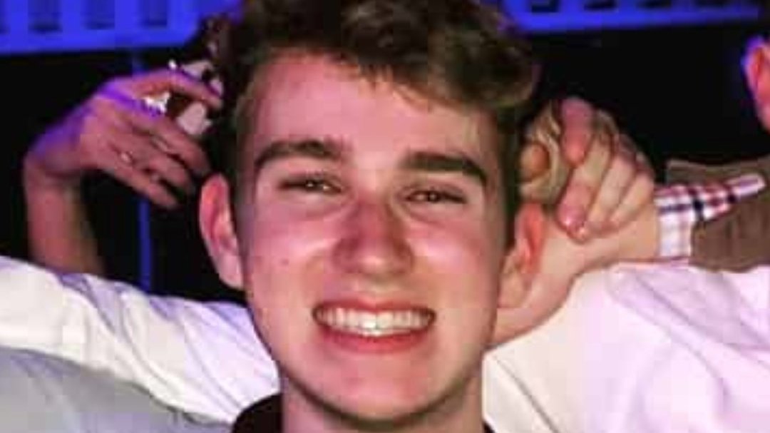 Petition · Wax oisin's lower back - Dublin, Ireland · Change.org