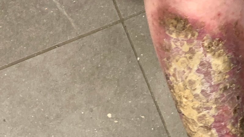 Petition · RPAH cancelling urgent appointments for seven months ...