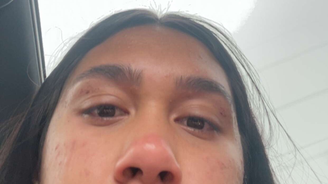 Petition · Calah Kuresa H-Factor - Australia · Change.org