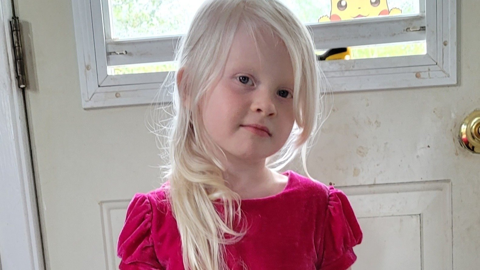Petition · Recognize albinism as a disability for tax credit - Canada ...