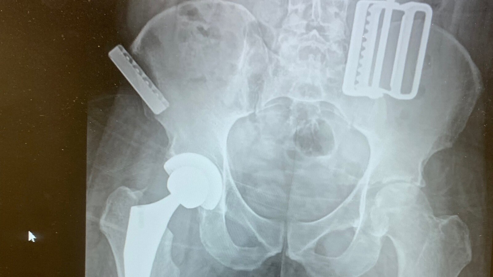 Petition · Workers Deserve Fair Workers’ Compensation Reform Now ...