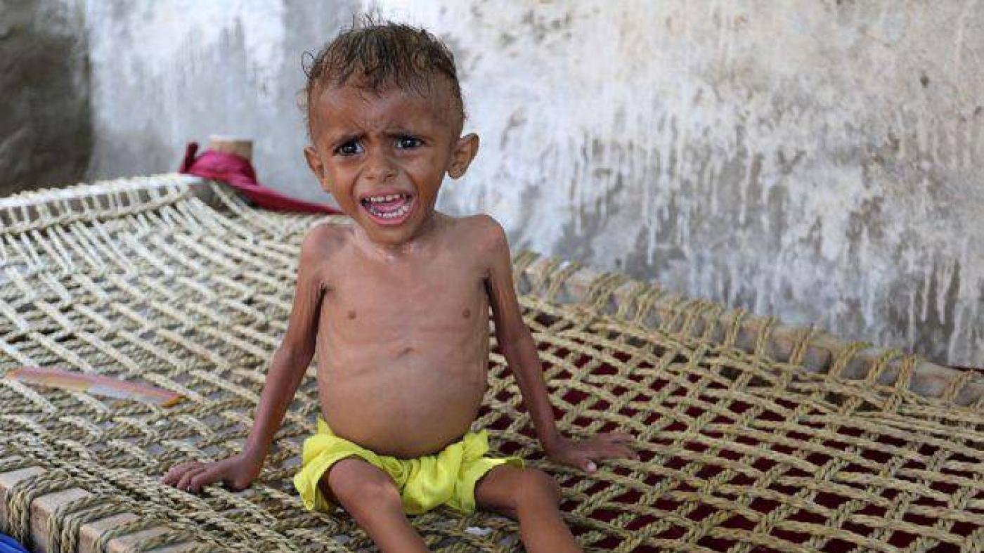 Petition · Stop the famine in Yemen! - United Kingdom · Change.org