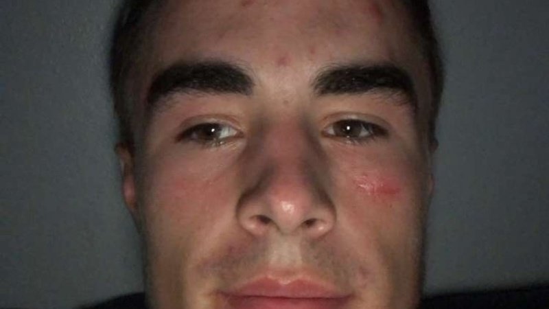 Addison Schmitz's Instagram, Twitter & Facebook on IDCrawl