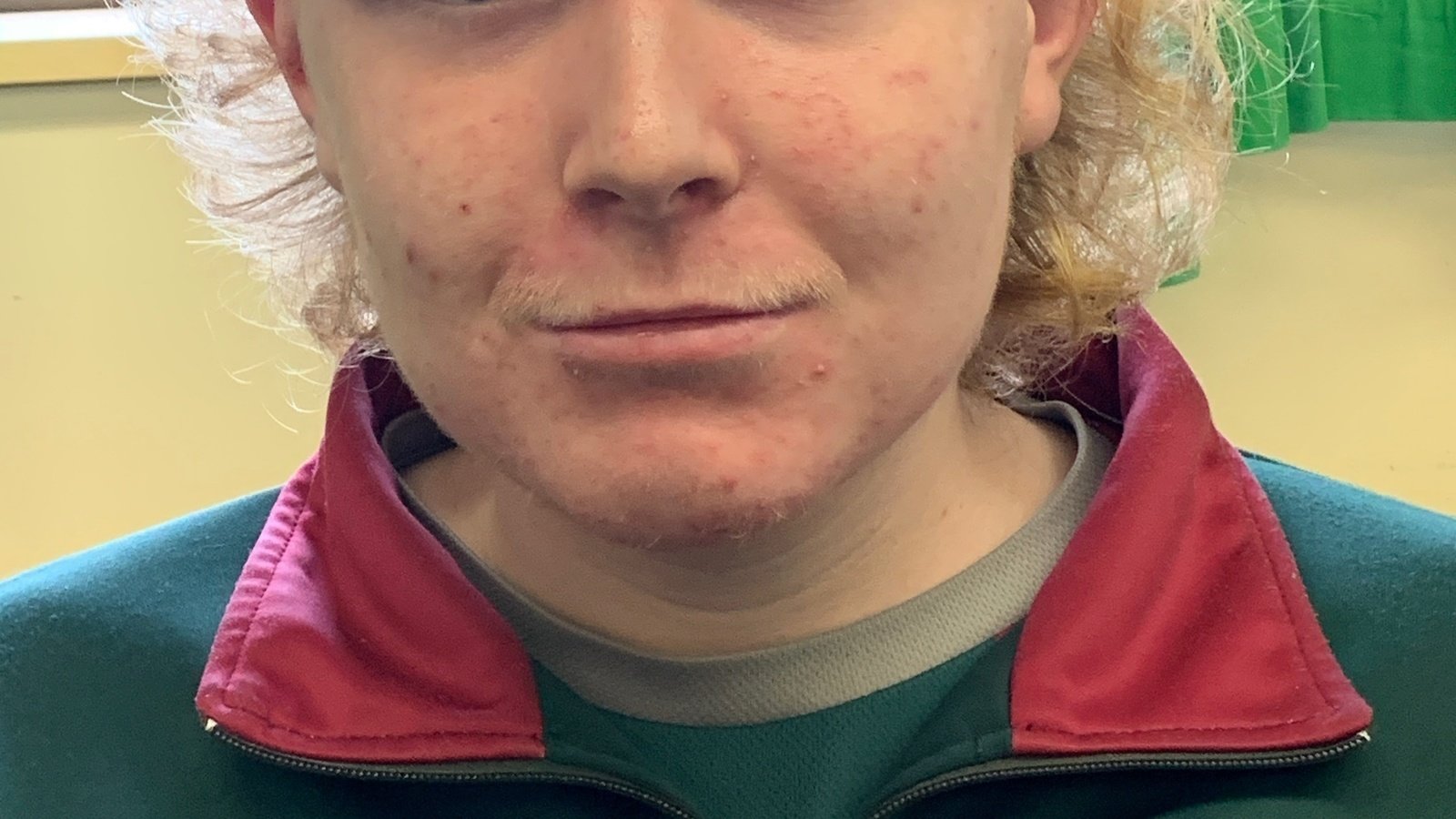 Petition · Let Declan go on camp · Change.org