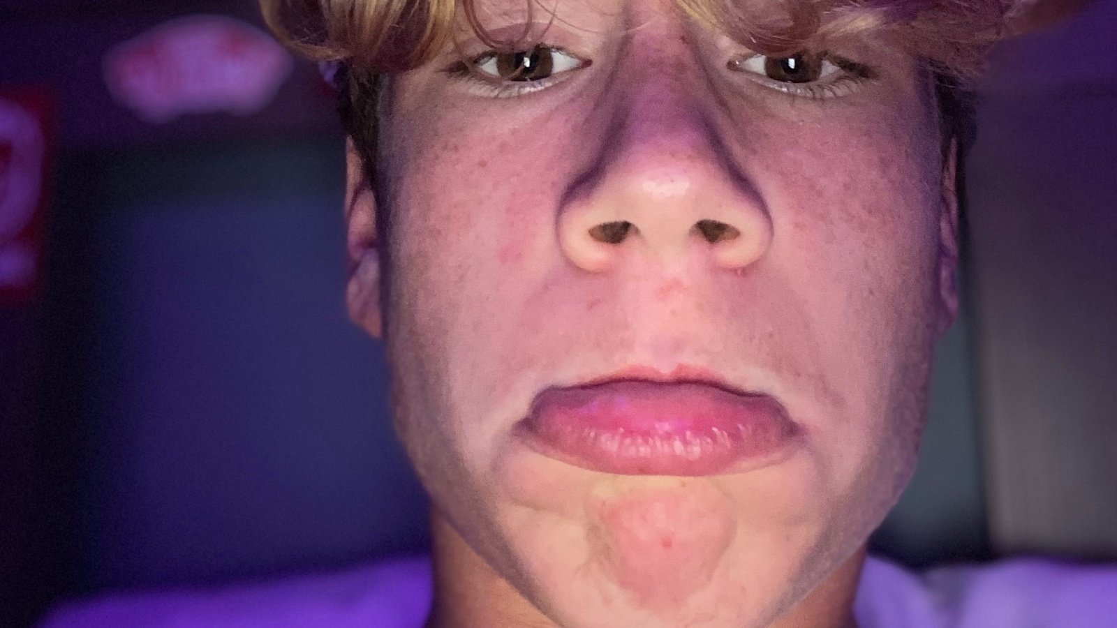 Petition · Let Chase Calhoun tap - United States · Change.org