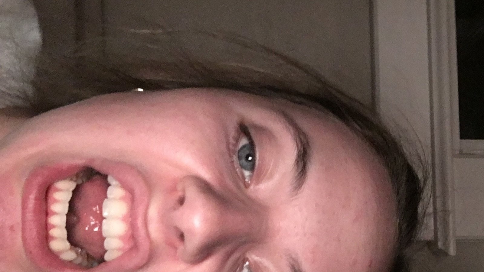 Petition · $25 per wisdom tooth from the tooth fairy - United States ...