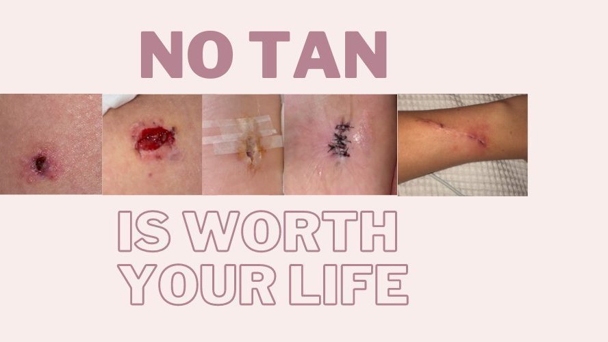 Petition · NO TAN IS WORTH YOUR LIFE! - Ban tanning beds in UK - United ...