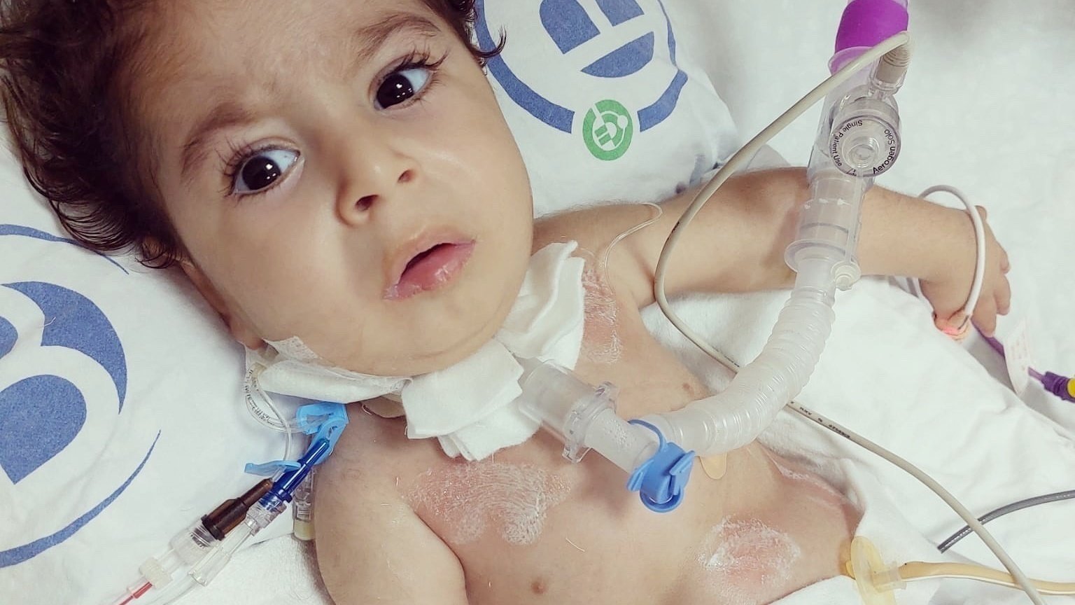 Petición · Help Ömer (SMA type1 Baby) - Alemania · Change.org
