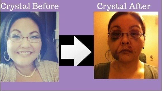 Petition · Give Crystal McDonald her voice back - United States ...