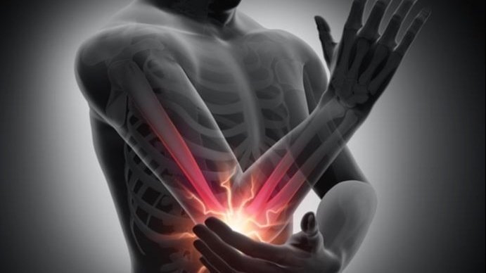 Petition · Call the funny bone the unfunny bone - United States ...