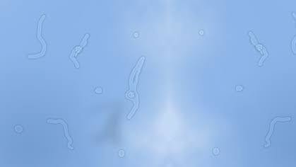 Kampanya · Göz Hastaneleri floaters tedavisi için doktor feike ...