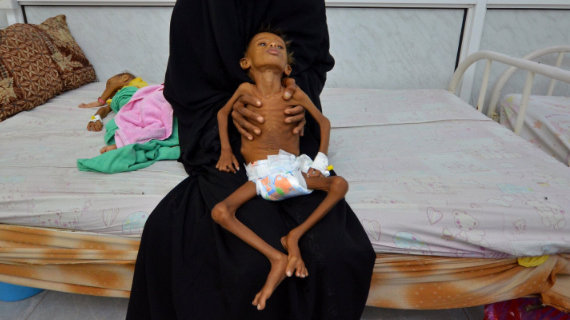 Petition · Famine/Genocide In Yemen - Ireland · Change.org