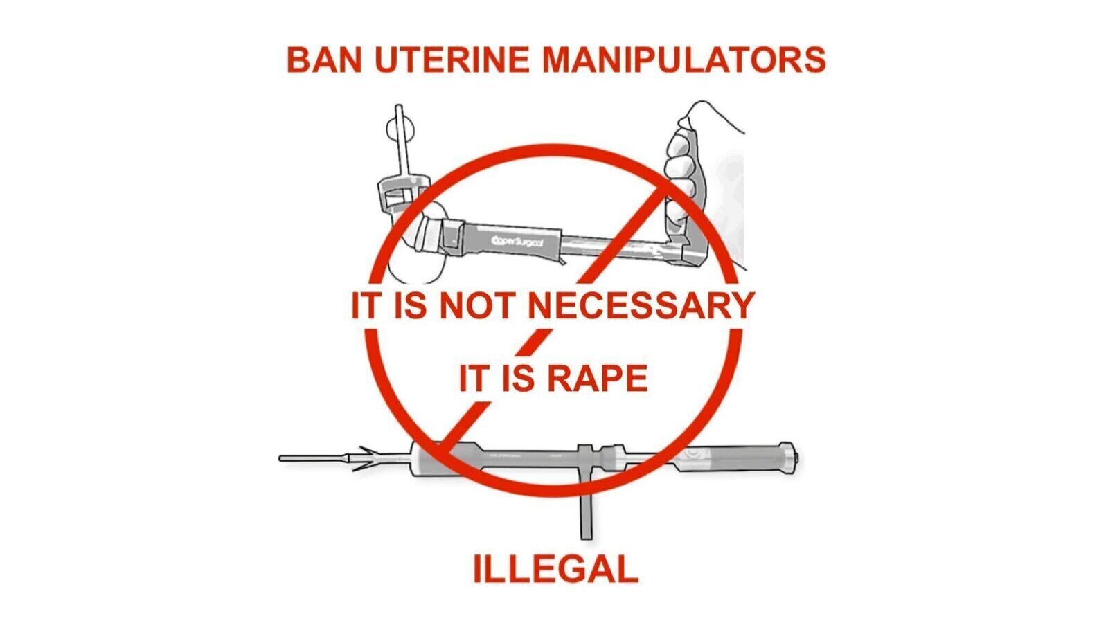 Petition · Permanently Ban the Illegal Assault Weapon Uterine Manipulator · Change.org