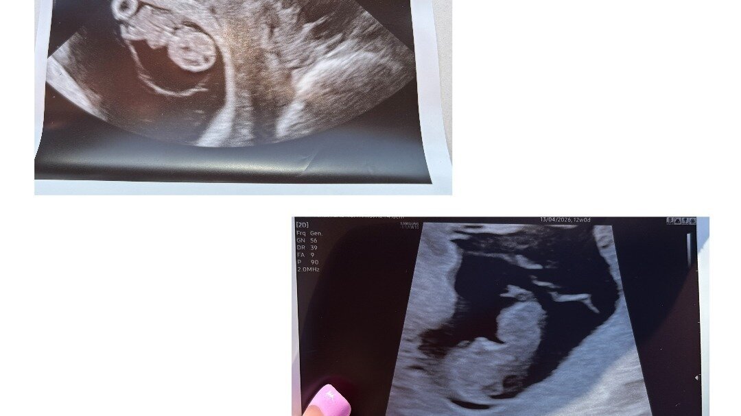 Petition · Demand Accountability for Pregnancy Neglect at St George’s ...