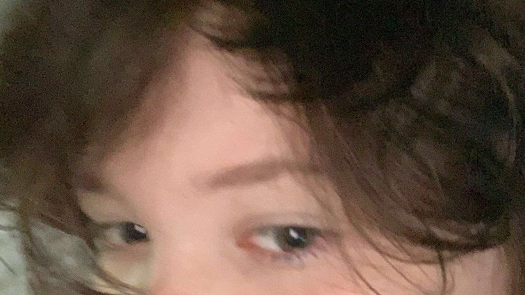 Petition · landyn should go bald - United States · Change.org