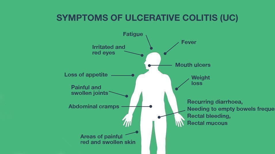 Petition · Ulcerative Colitis Disease - United States · Change.org