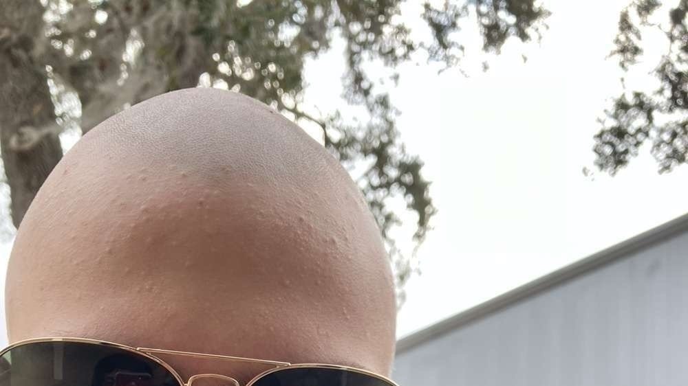 Petition · STOP BUZZCUTS - United States · Change.org