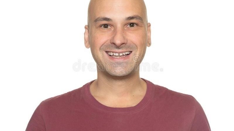 Petition · Casper . n being bald - Norway · Change.org