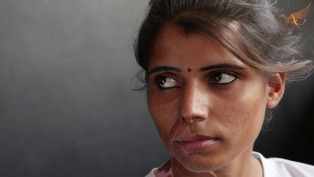 Petition · STOP ACID ATTACKS & SUPPORT THE VICTIMS · Change.org