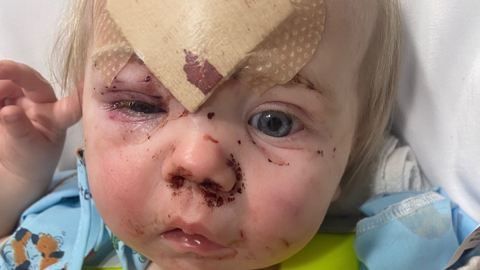 Petition · Put down the dog - Keene, United States · Change.org