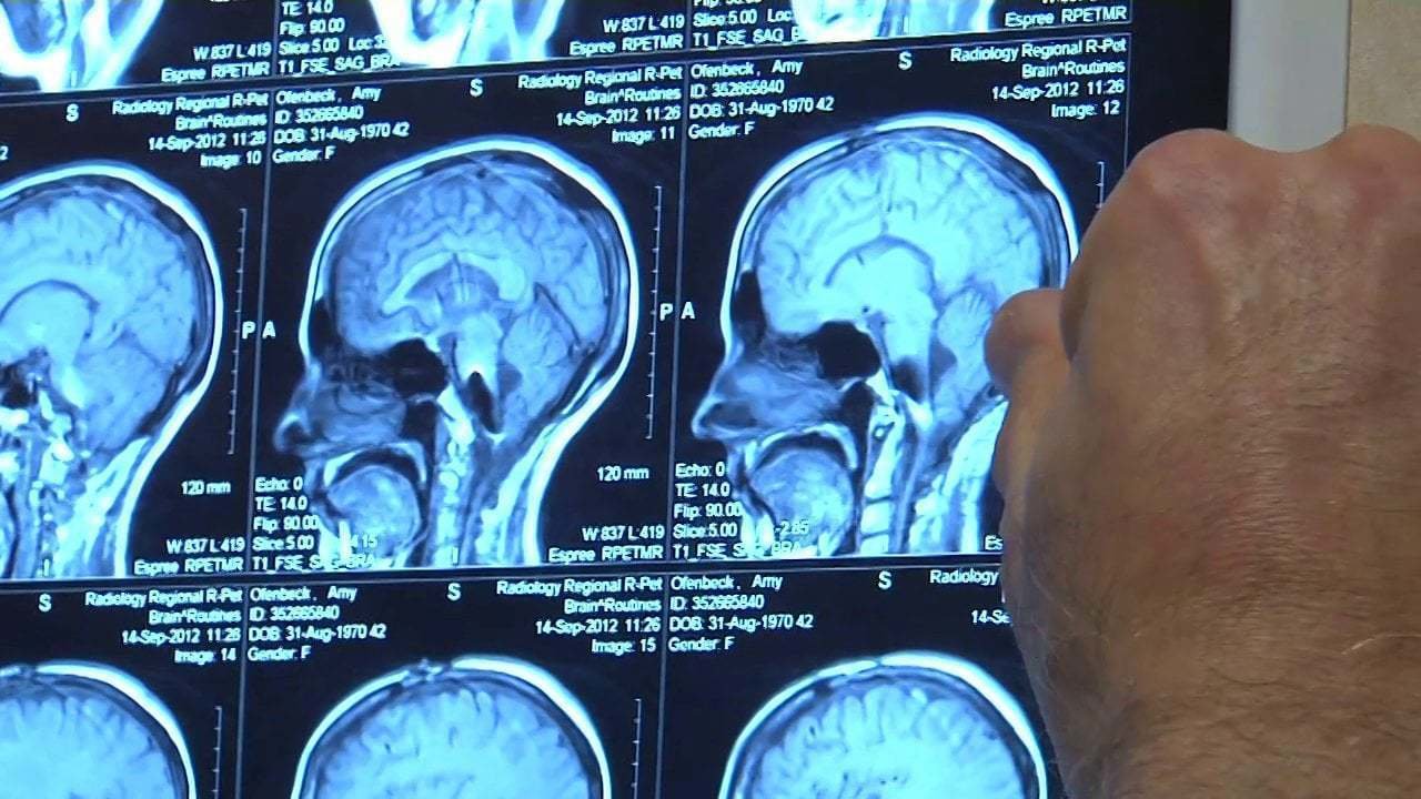 Petition · Blue Cross Blue Shield TN: Please GIVE MY Brain Injured ...