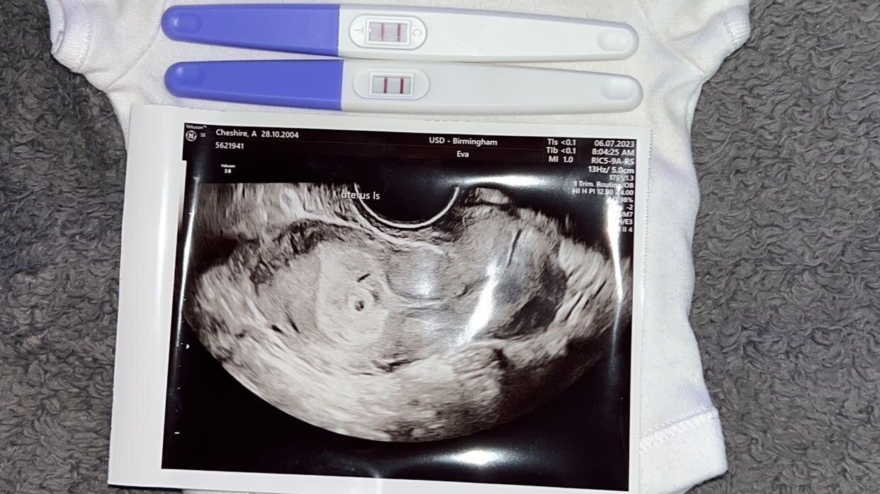 Petition · care for women after miscarriage - United Kingdom · Change.org