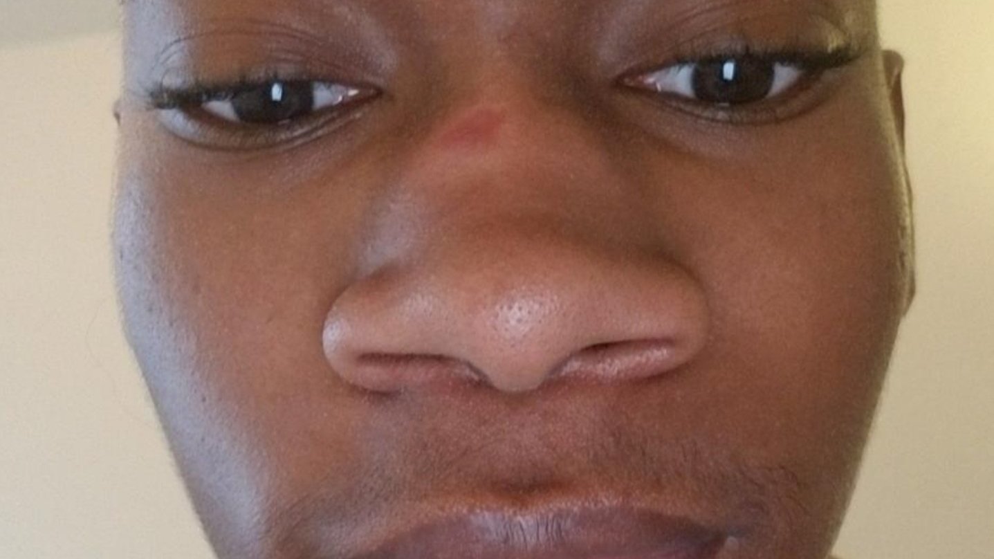 Petition · Extreme ugliness should be considered a disability - United ...