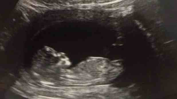 Petition · Give every woman a scan after a miscarriage · Change.org