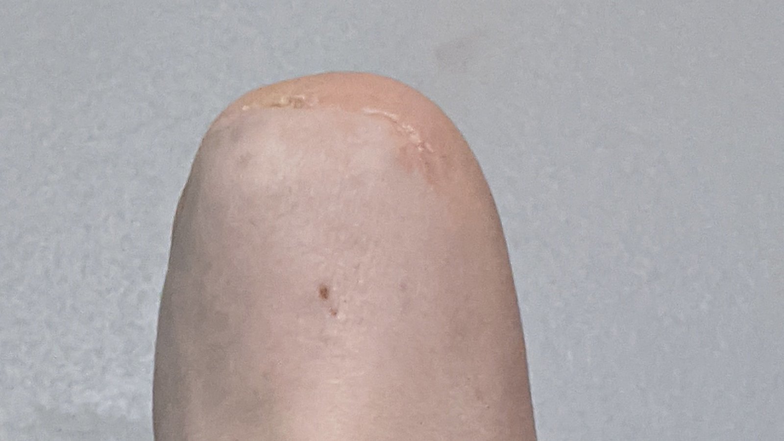 Petition · I want Amazon to compensate me for losing half a foot ...