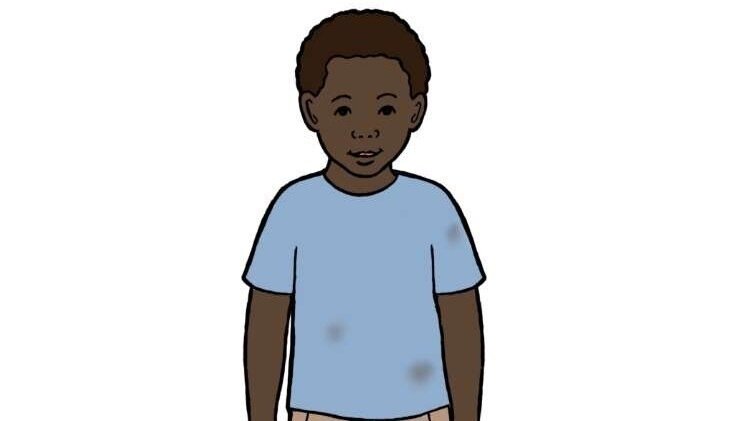 Petition · Ban monkeys named olaf - United States · Change.org