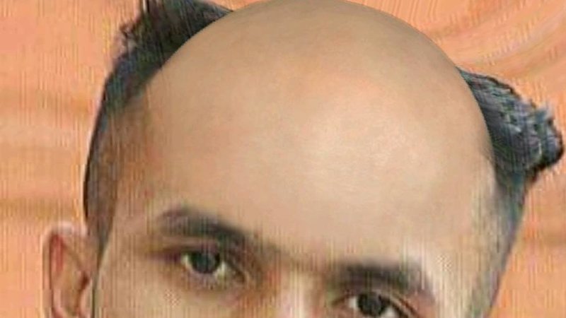 Petition · Make Ayush Batala go bald · Change.org