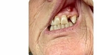 Petition · MISSING TEETH SUCKS and equals pain + shame + guilt + fear ...