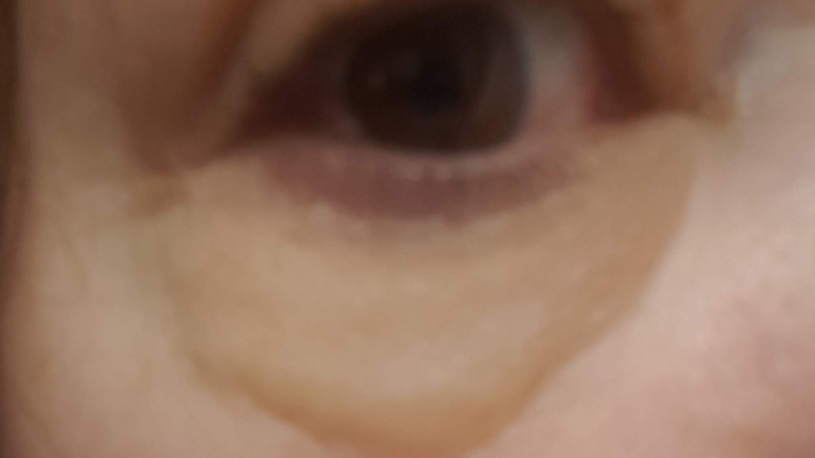 Pétition · Basedow · Change.org