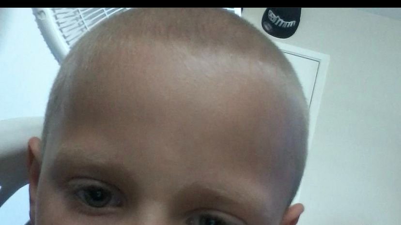 Petition · for caydin to get hair - United States · Change.org