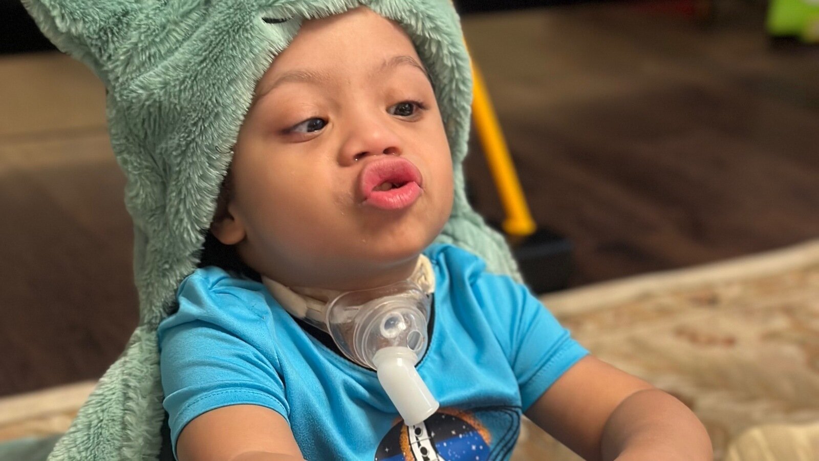 Petition · Secure Access to REM Nursing for Child with Severe ...