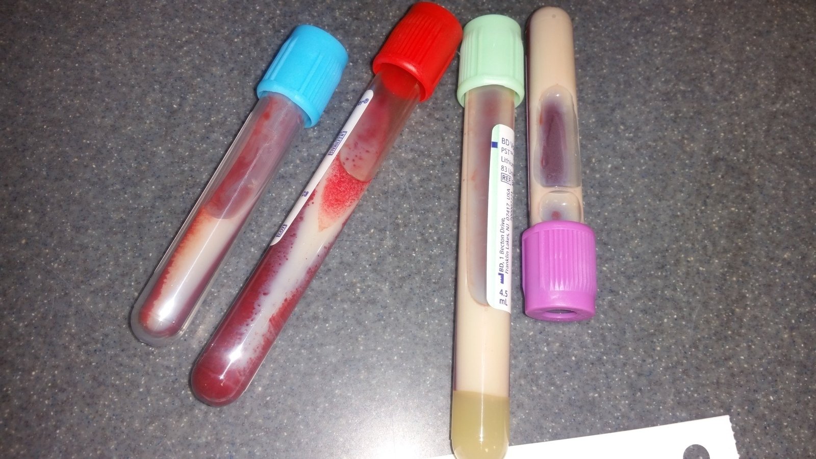 Petition · FDA Denies the Only Treatment for FCS patients! - United ...