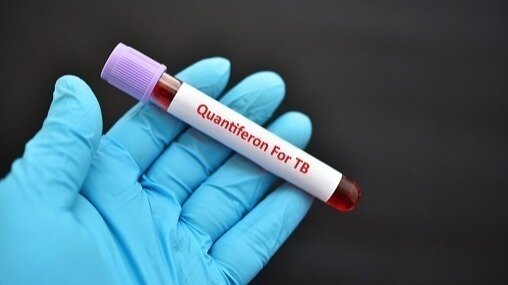 Kampanya · Quantiferon Testi Devlet Hastanelerinde Ücretsiz Yapılmalı ...