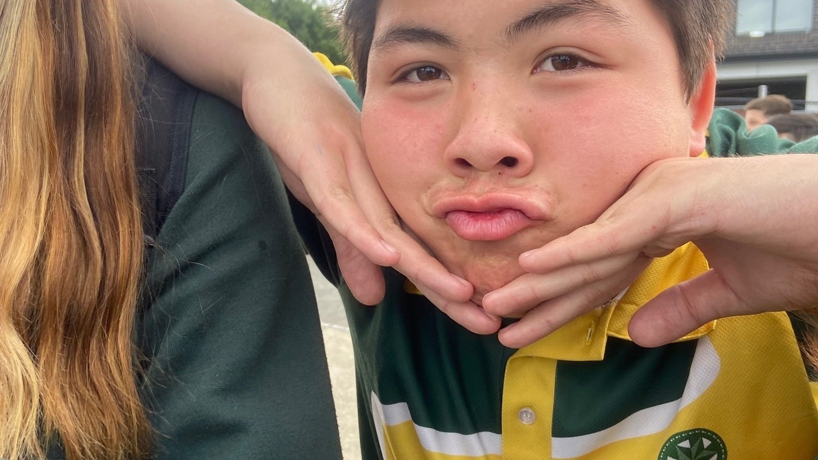 Petition · Let harry come to rhys party - Australia · Change.org