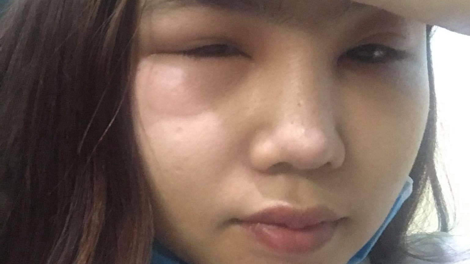 Petition · Justice for Le Do Phuong Uyen & domestic violence victims - Vietnam · Change.org