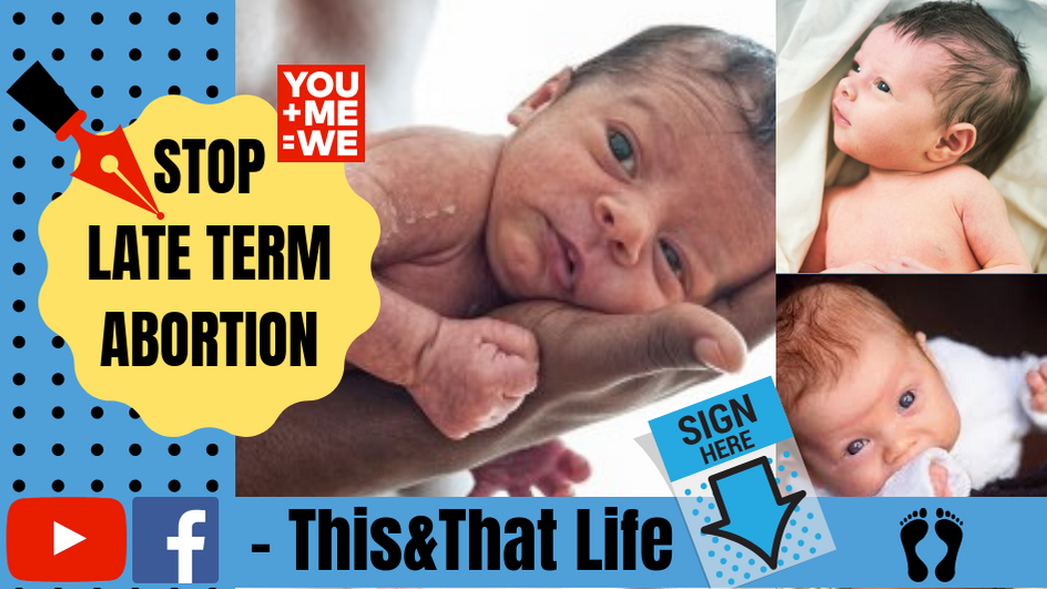 Late Term Aborted Babies