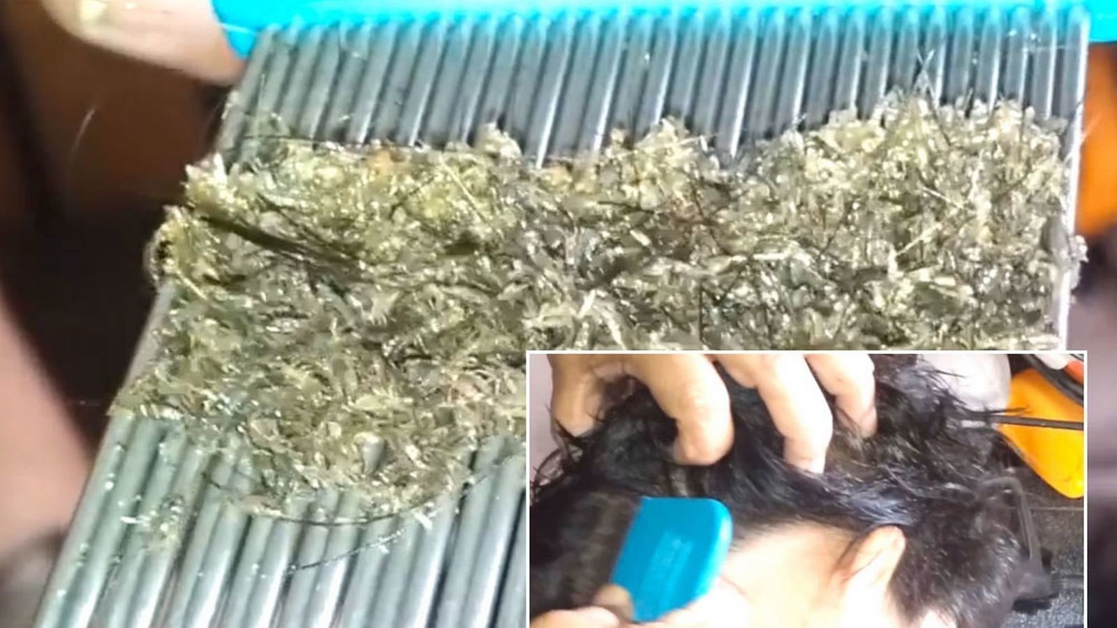 Petition · Keep both nits and lice out of our classrooms - return to ...